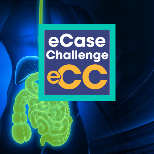 eCase Challenge 2: Effective Diagnosis and Management of IBS Improving ...